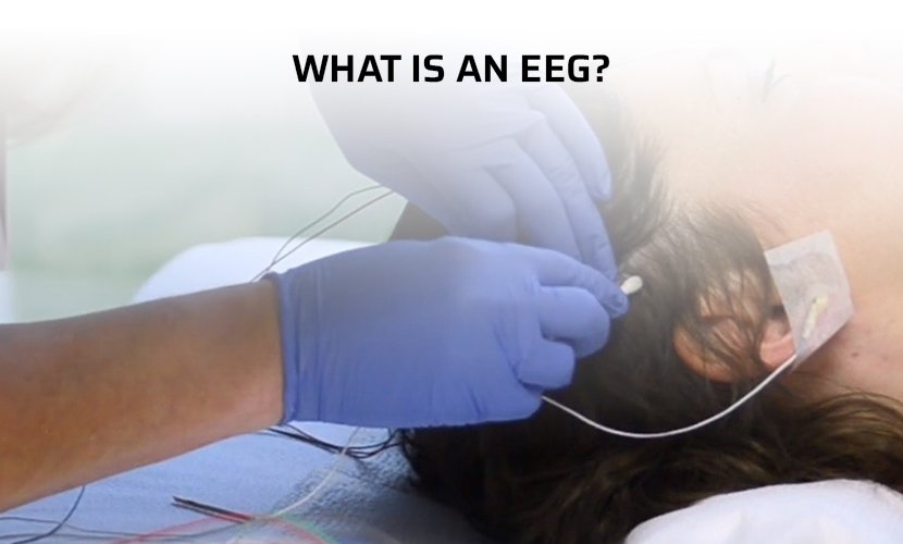 EEG and ECG